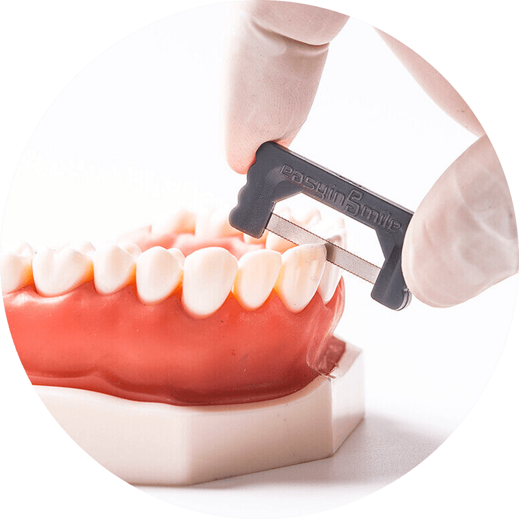 Wat is IPR? – Interproximale reductie bij alignerbehandelingen ...